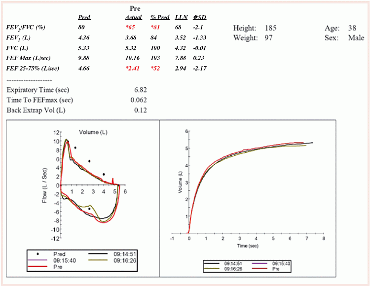 Spirometria