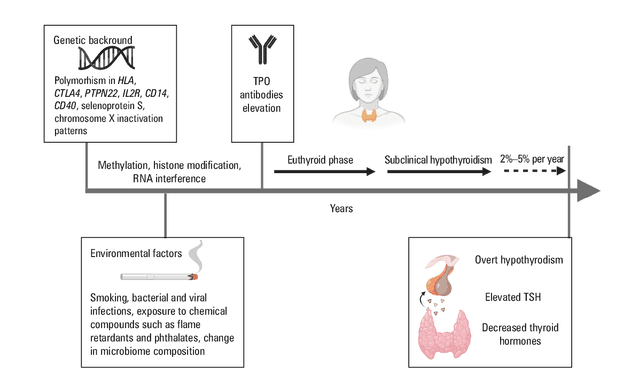 Hashimoto thyroiditis: an evidence-based guide to etiology, diagnosis ...